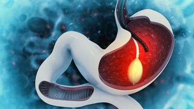 Granite State Gastroenterology | GI Clinic Southern NH